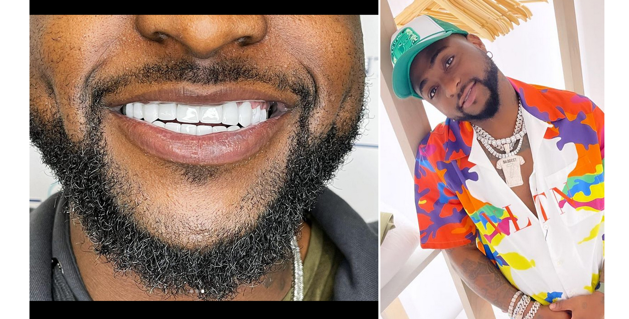 Singer, Davido shows off his sparkling set of teeth - 102.3 Max FM